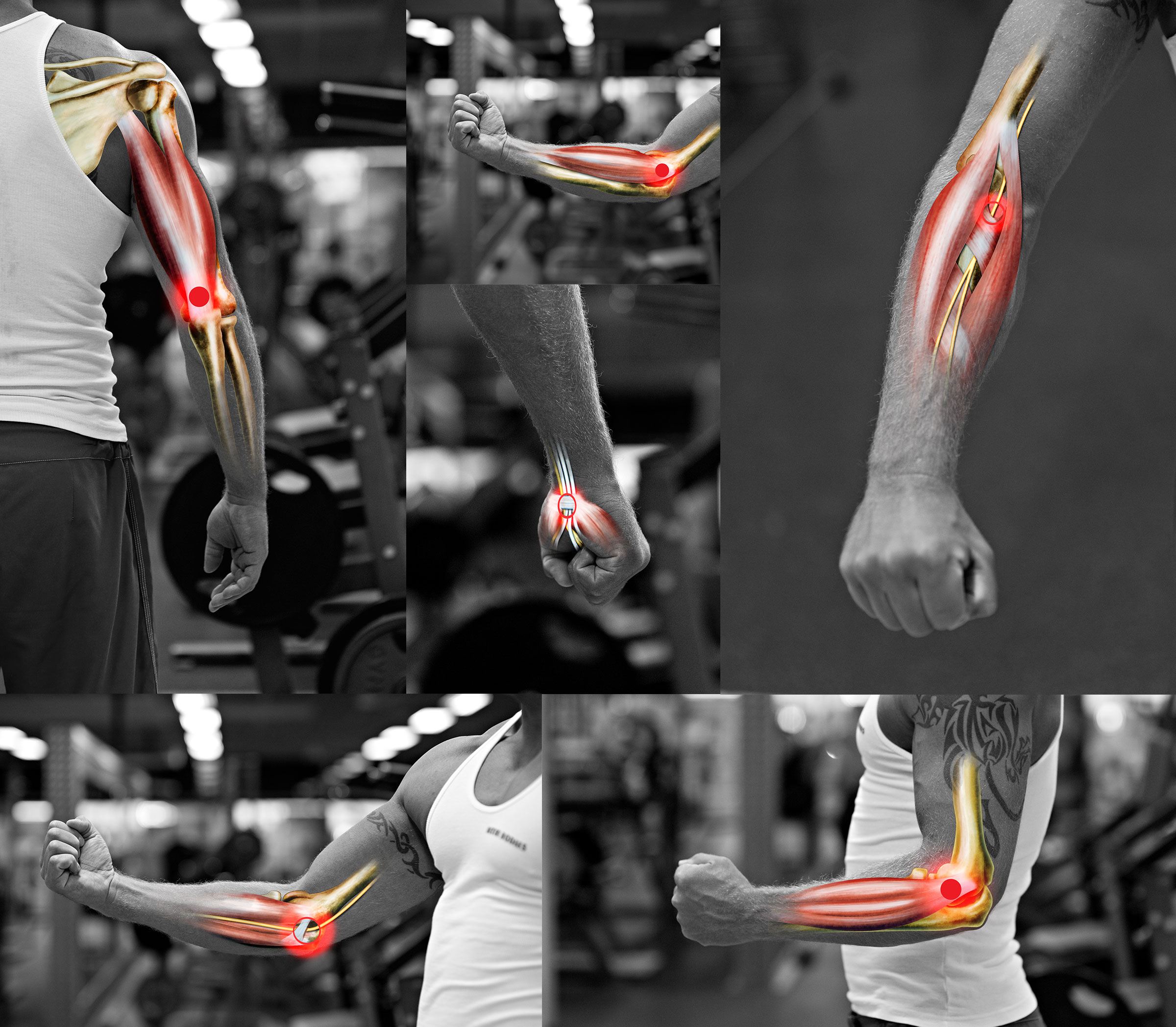 Träningsskador - Illustratörcentrum