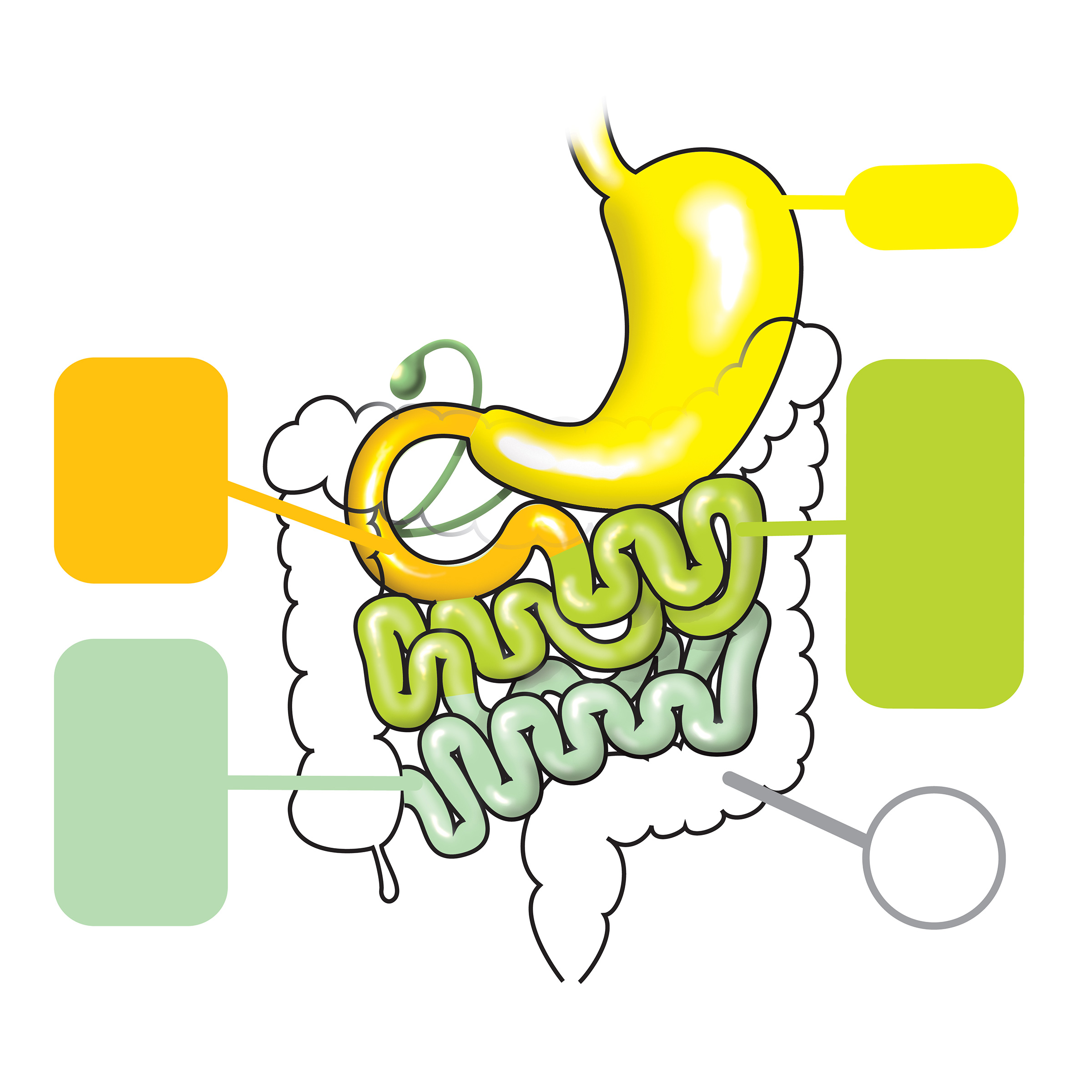 Obesitaskirurgi - Illustratörcentrum