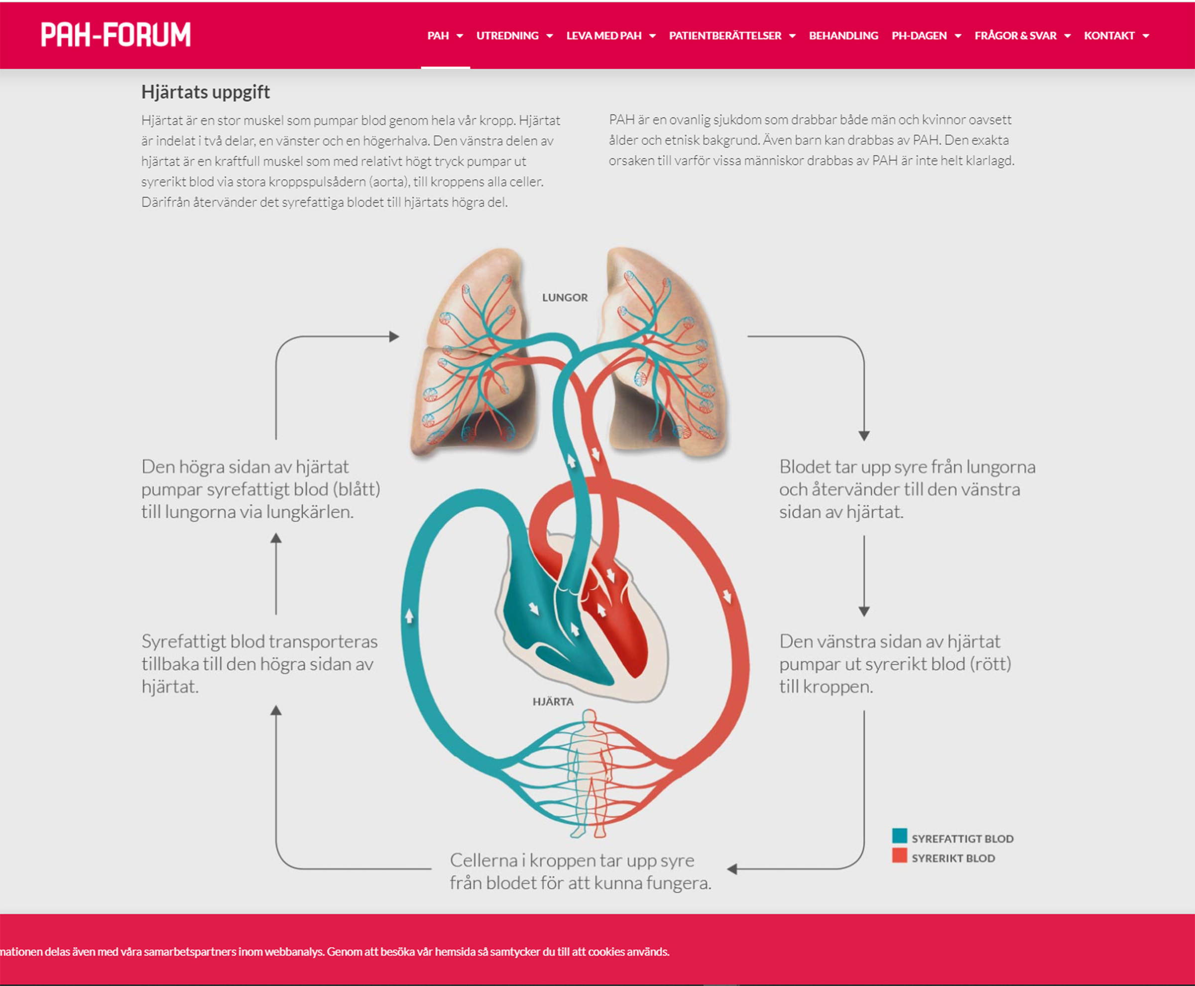PAH, pulmonell arteriell hypertension - Illustratörcentrum